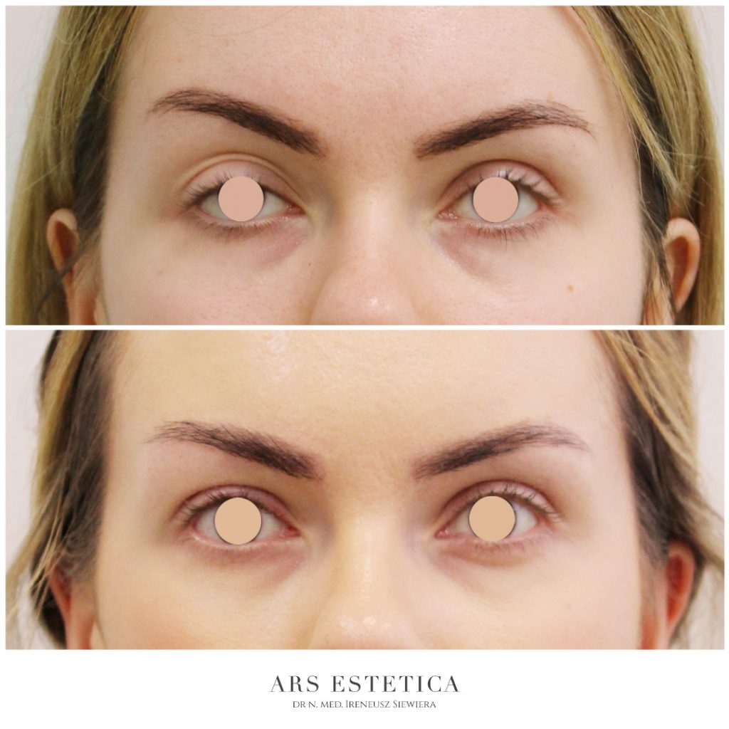 Operacje plastyczne twarzy | Ars Estetica - Wrocław i Warszawa