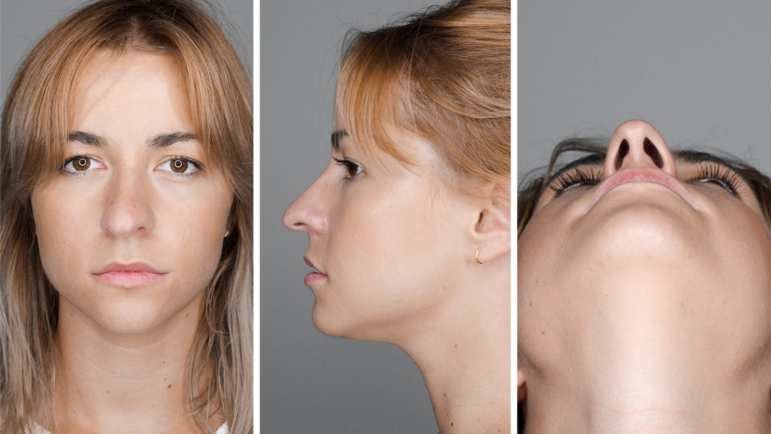 Prostowanie przegrody nosowej – cena, rekonwalescencja, efekty